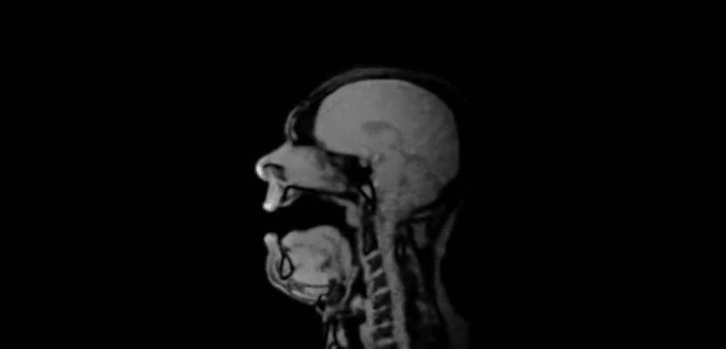 So That’s What it Looks Like When a Baritone Sings in an MRI | WQXR ...