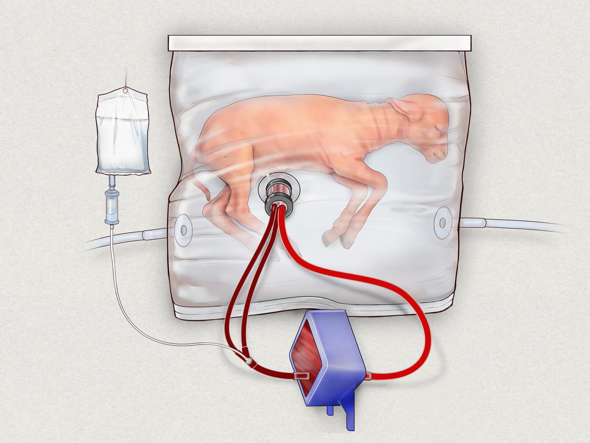 Scientists Create Artificial Womb That Could Help Prematurely Born ... Scientists Create Artificial Womb That Could Help Prematurely Born ...