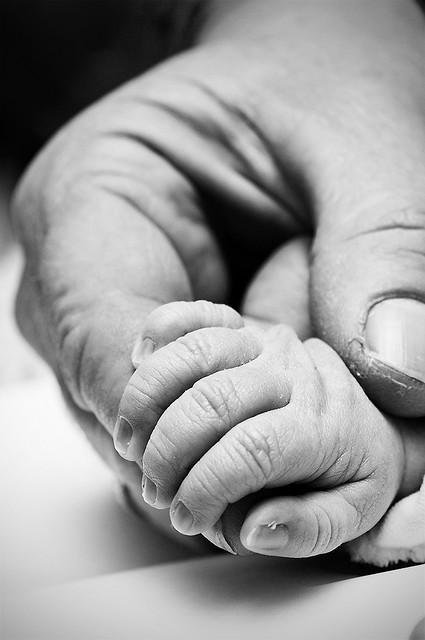 The Case of the 'Cyclops Child' | The Takeaway | WNYC Studios