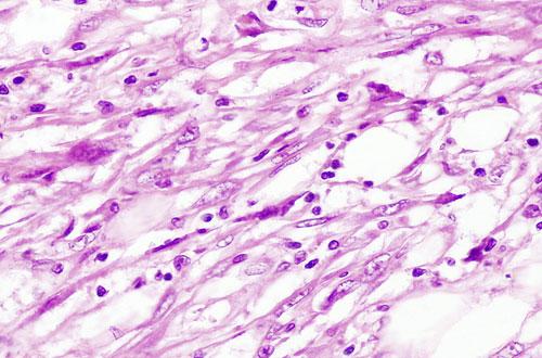 Spindle Cells | Radiolab | WNYC Studios