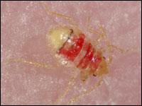 A Bed Bug Solution At The Bed Bug Summit The Takeaway Wnyc Studios